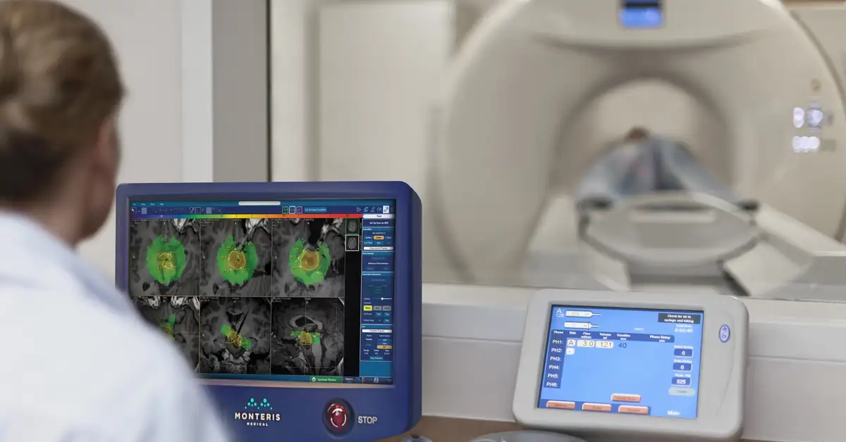 A paradigm shift in minimally invasive neurosurgery | SCHOTT